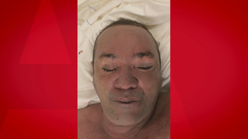 Politie kan identiteit dode man niet achterhalen en deelt foto's van ...